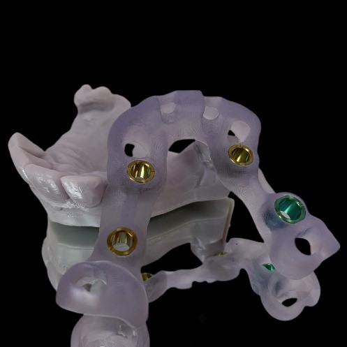 Surgical Guides | Successful Procedures | Our Products | Apex Dental ...